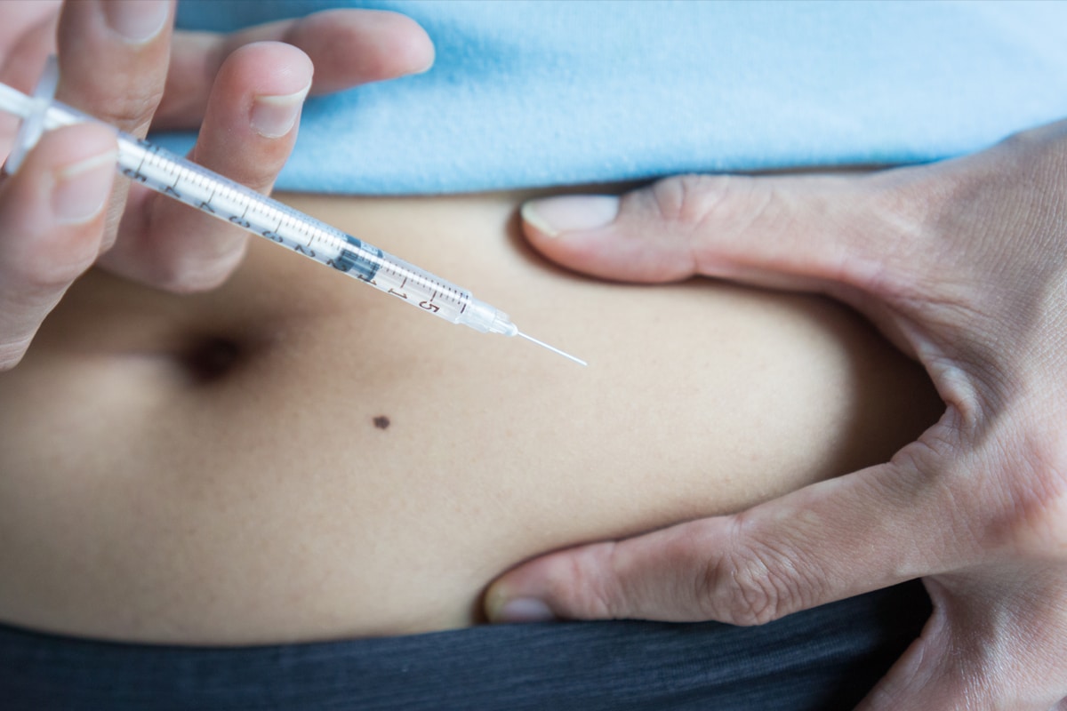 Insulin Delivery Using Stem Cells - Axxiem